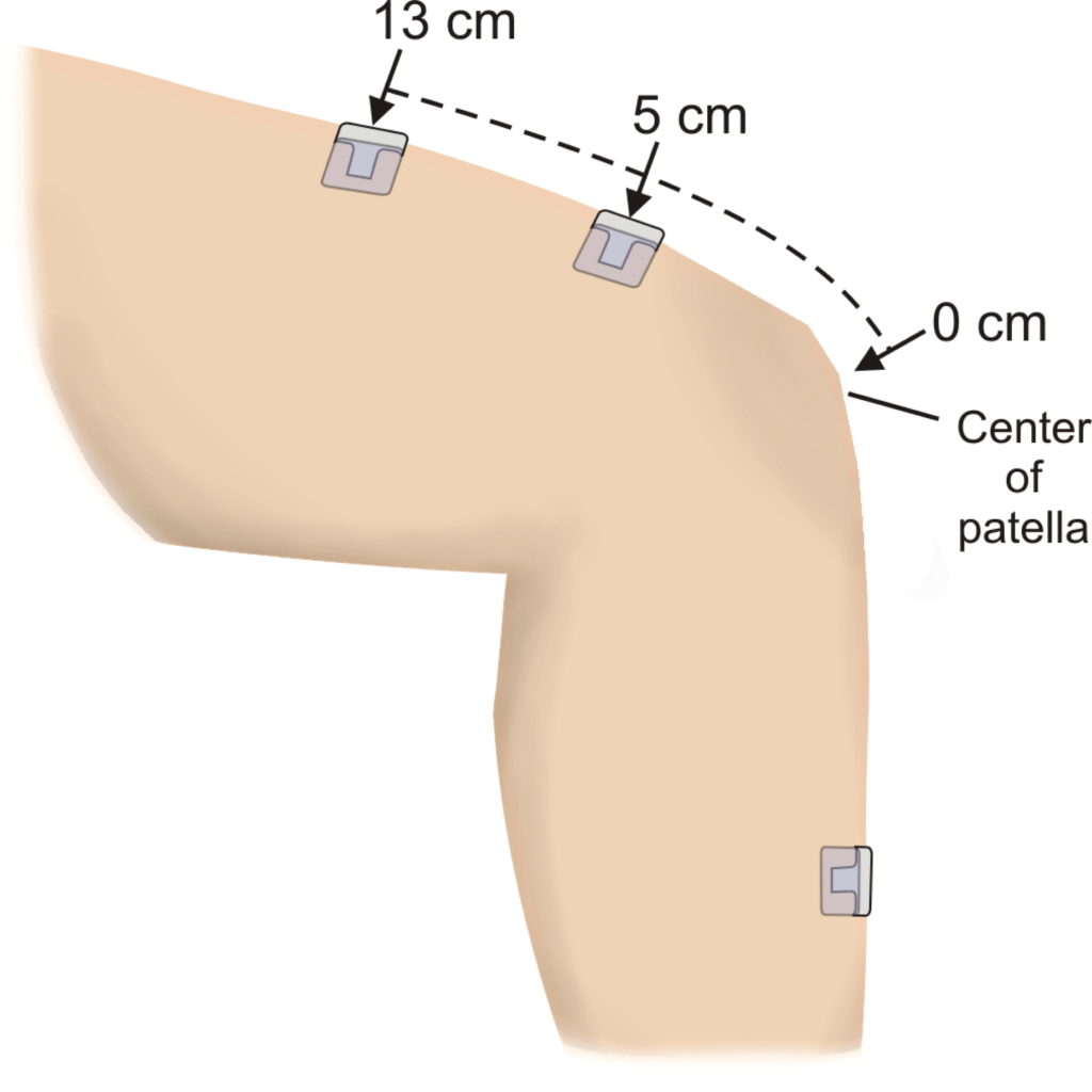 Neuromuscular Reflexes (without Accelerometer) > Experiment 14B from ...