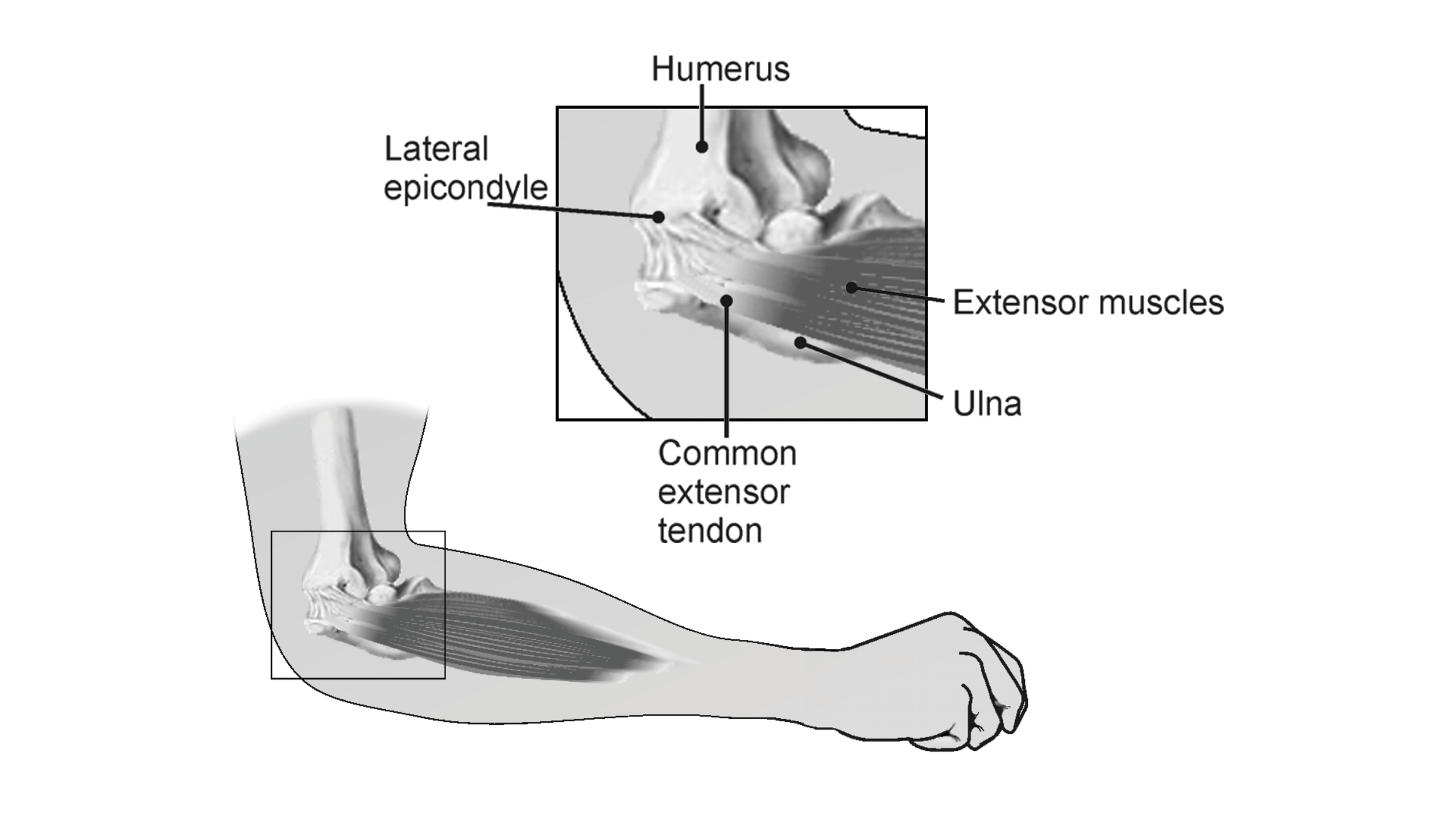 Muscle Function Analysis > Experiment 15 from Human Physiology with Vernier