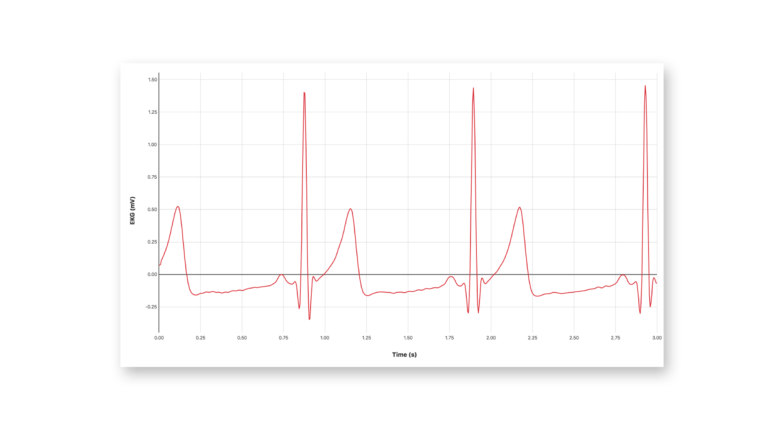 Go Direct® EKG Sensor - Vernier